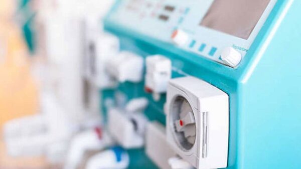 What Is Dialysis? Types, Process, and First Steps